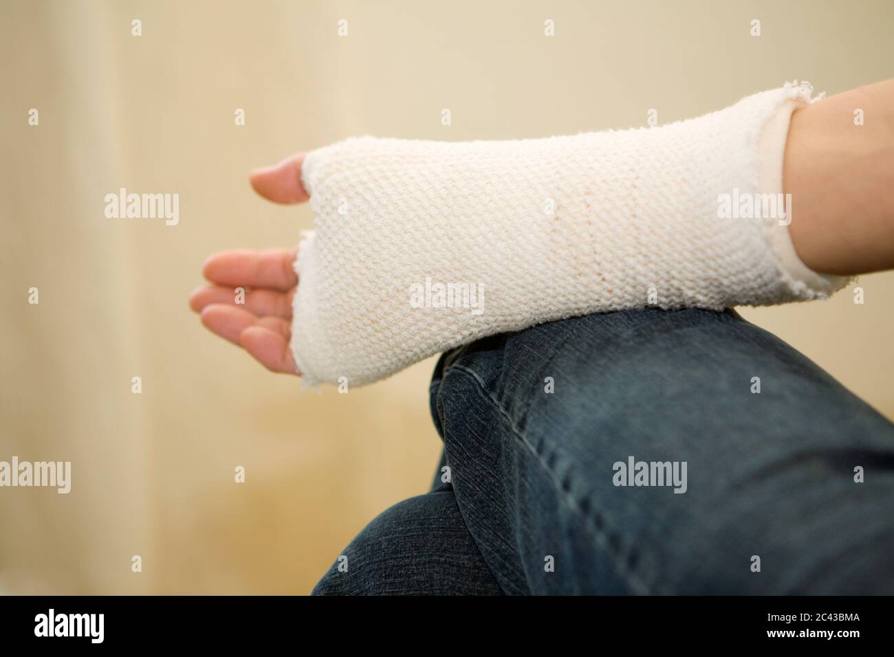 Cast arm hi-res stock photography and images - Alamy