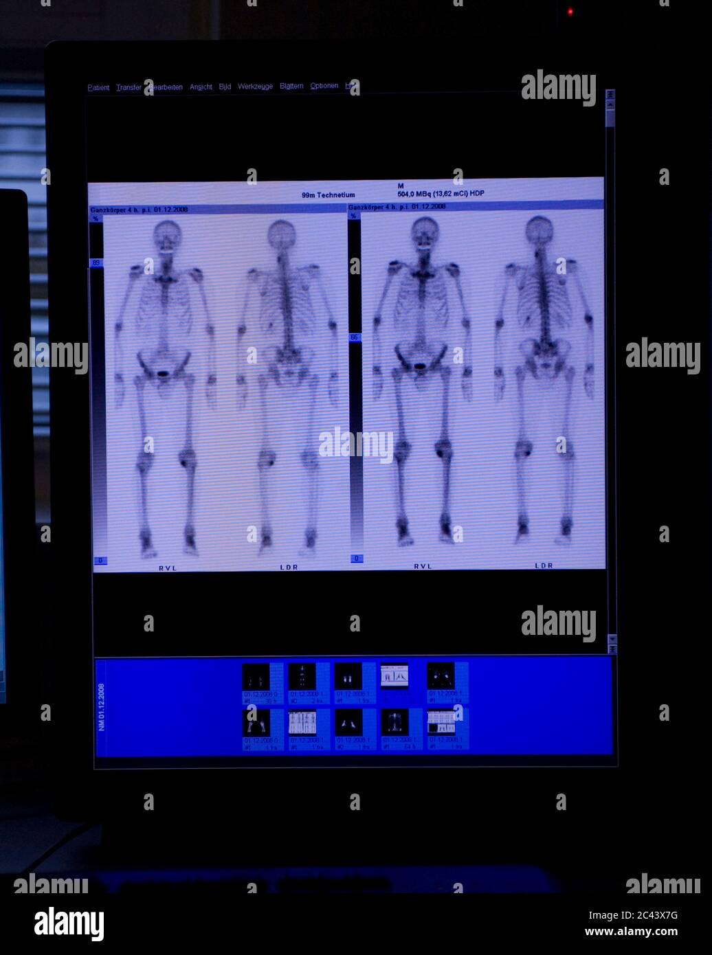 X-ray images of the human bone structure Stock Photo - Alamy