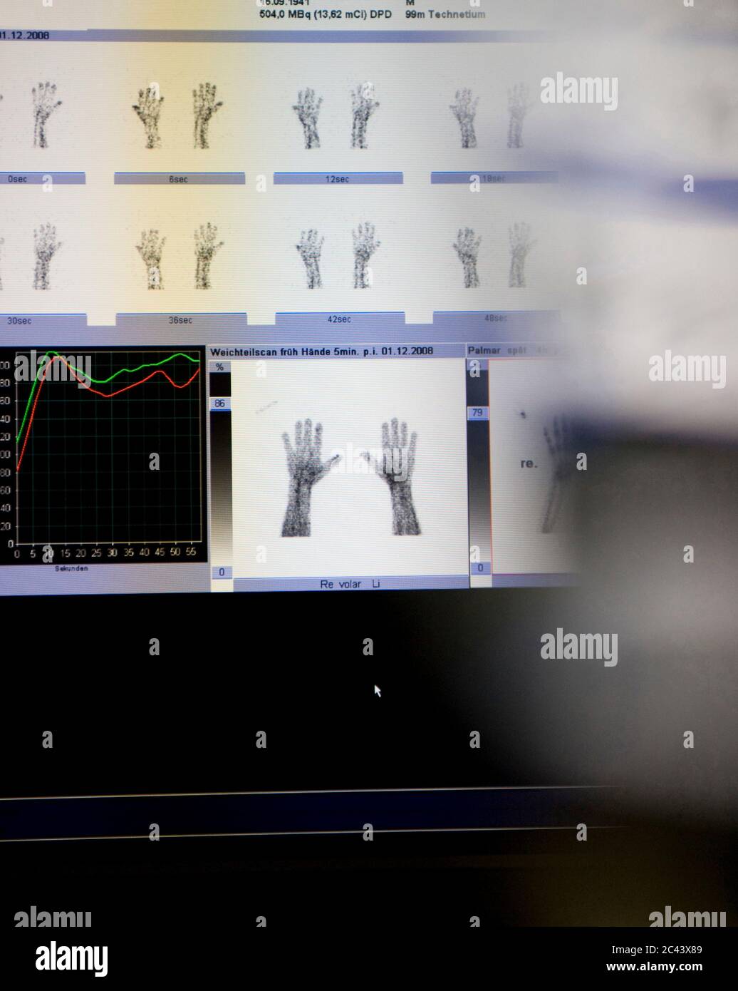 CT images of hands Stock Photo - Alamy