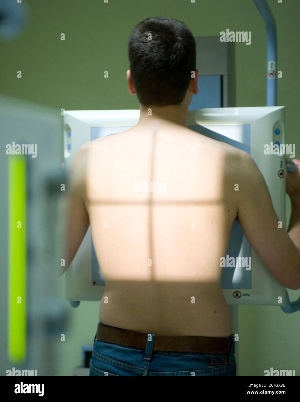 X-ray of patient in hospital Stock Photo - Alamy