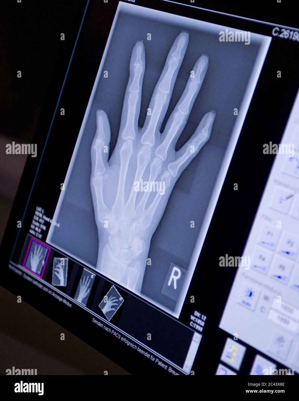 Hand central hi-res stock photography and images - Alamy