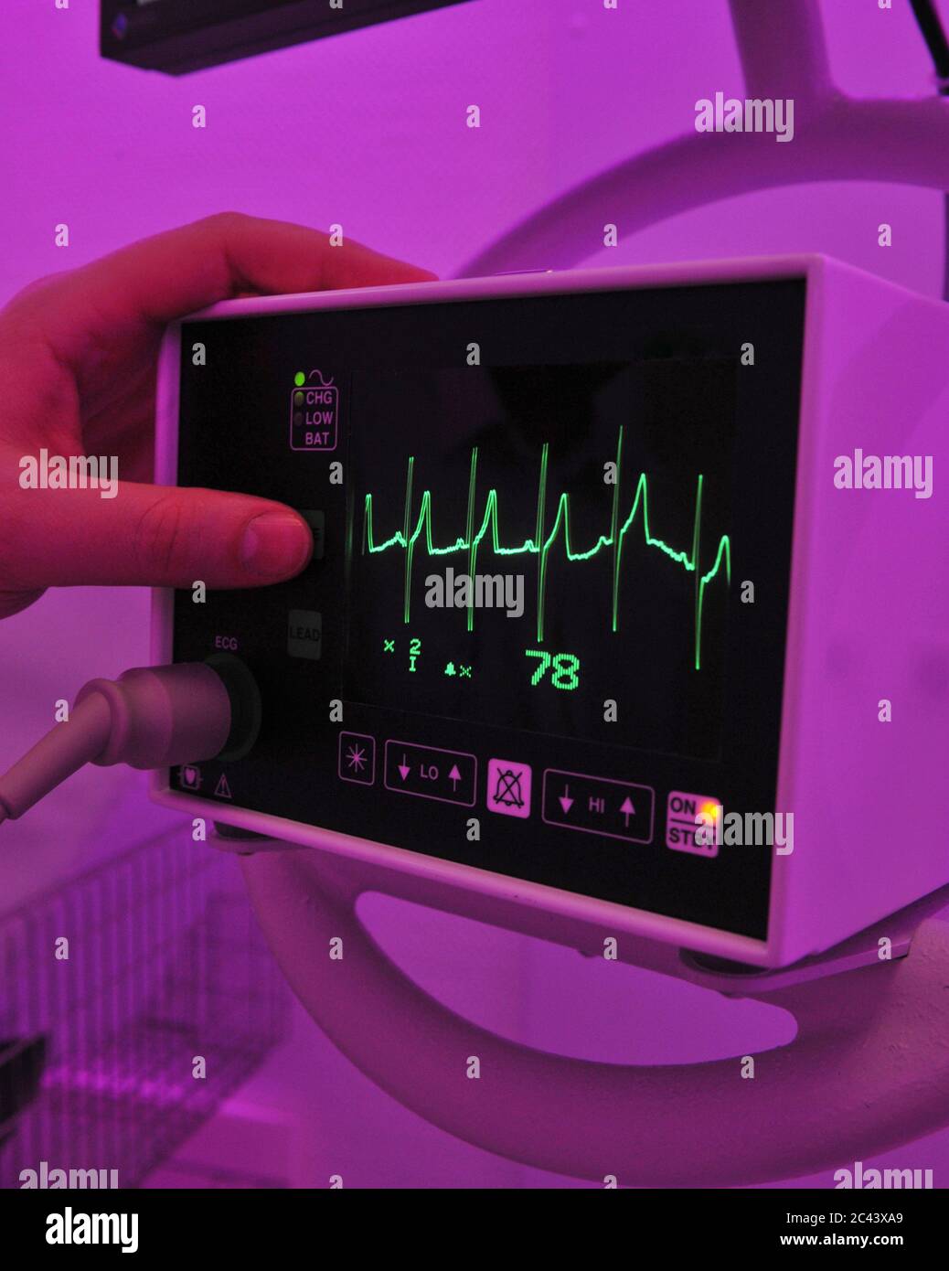 Hand and electrocardiograph Stock Photo - Alamy