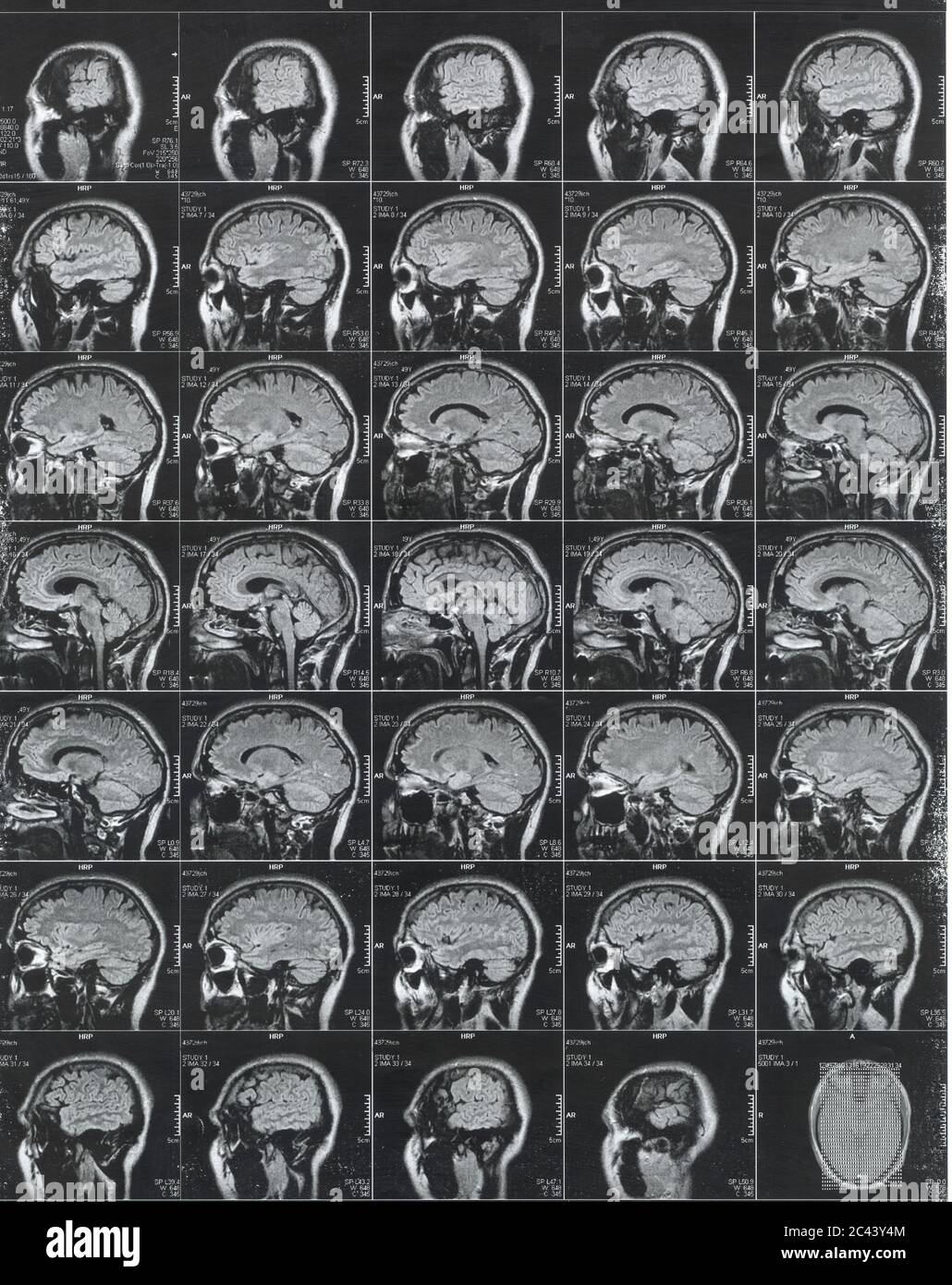 CT image of a head Stock Photo - Alamy