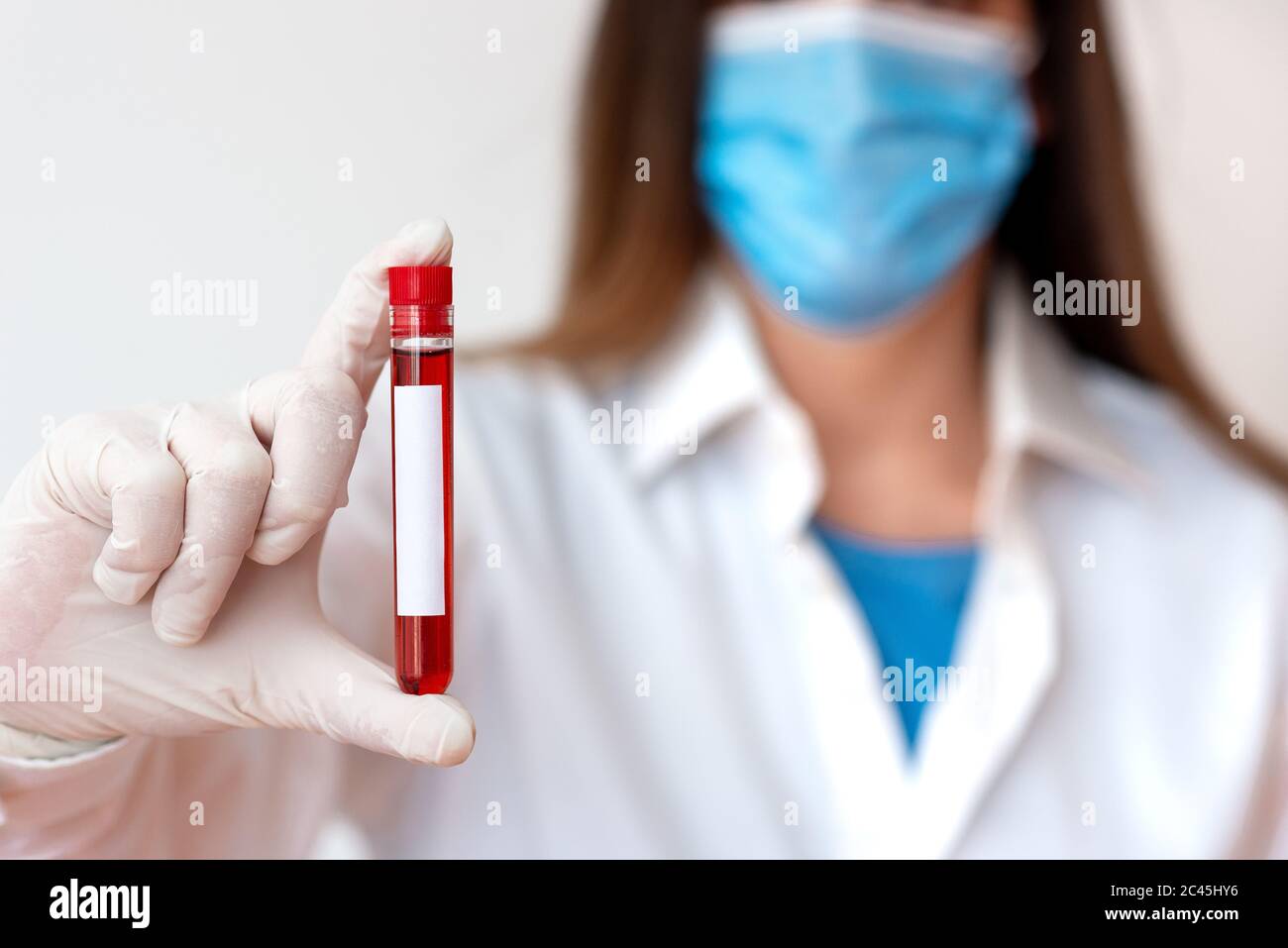 Laboratory Blood Test Sample Shown For Medical Diagnostic Analysis ...
