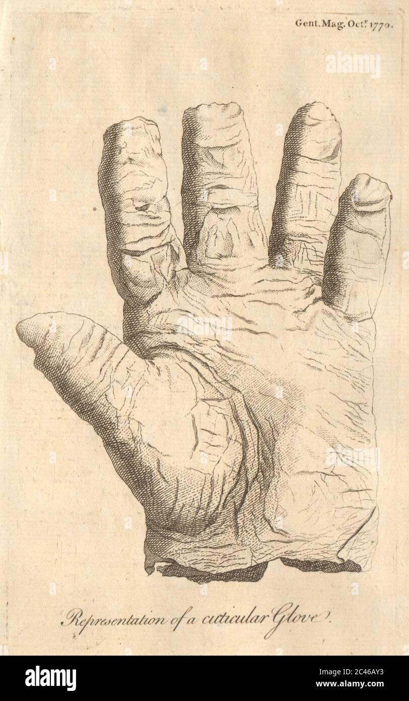 A cuticular glove, being the skin of a man's hand. Biology 1770 old ...