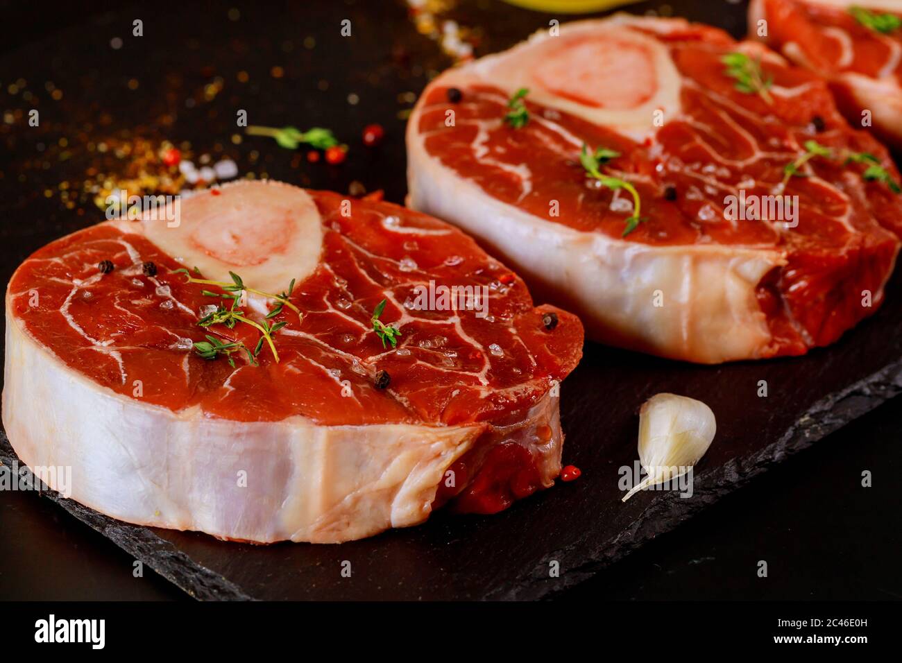 Shin Bone High Resolution Stock Photography and Images - Alamy