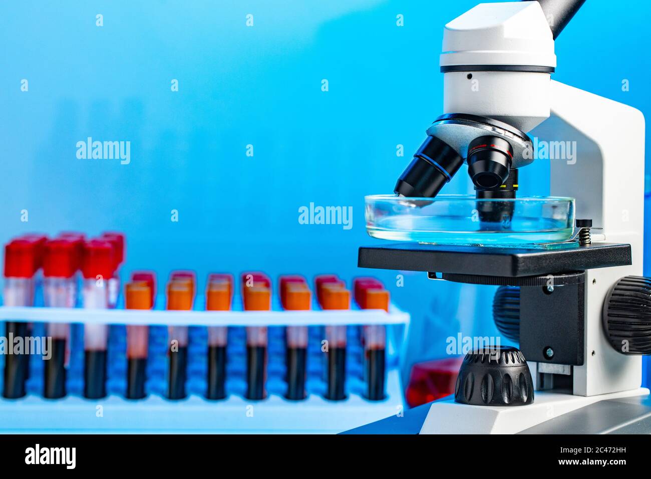 Photo laboratory microscope blood sample hi-res stock photography and ...