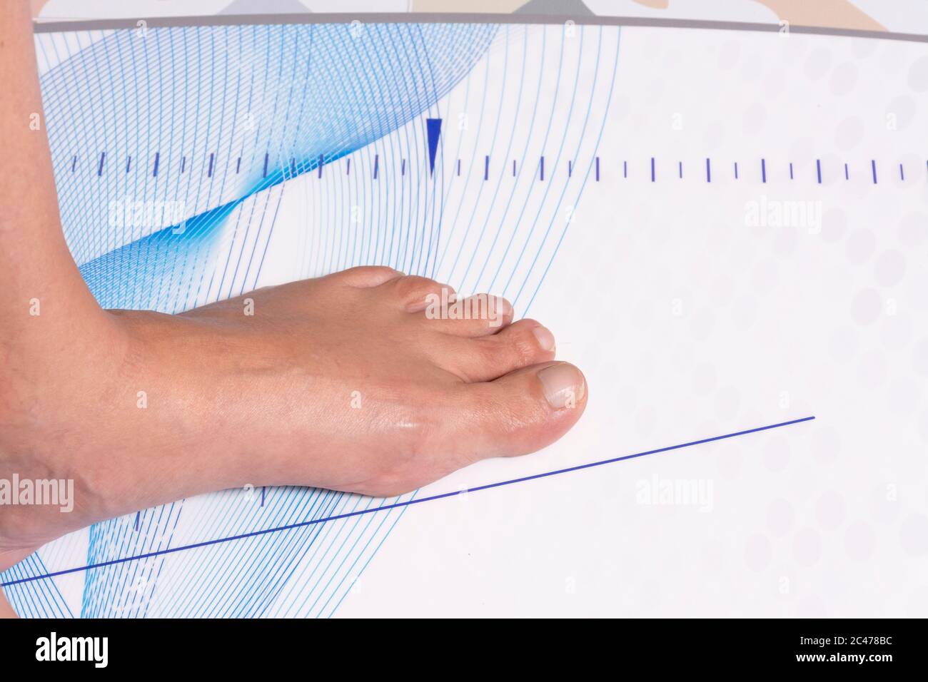Foot of a woman on the table for the biomechanical study of the tread ...