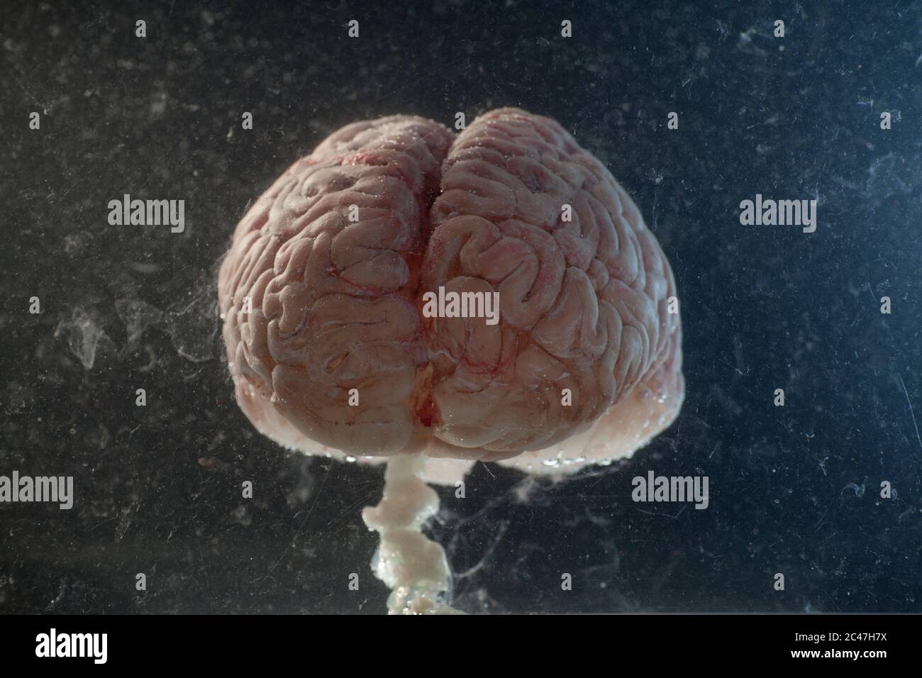 Brain floating in a tank of water Stock Photo - Alamy