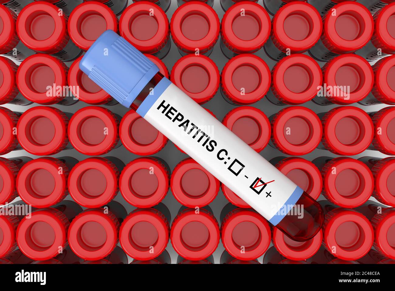 Hepatitis c test hi-res stock photography and images - Alamy