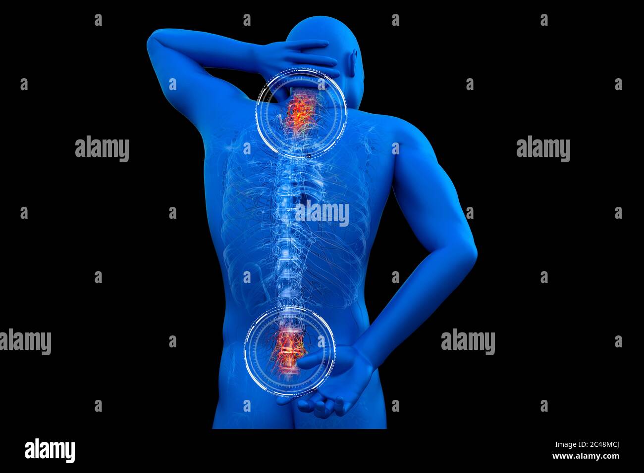 Anatomical vision back pain. Spine anatomy. 3D illustration Stock Photo ...