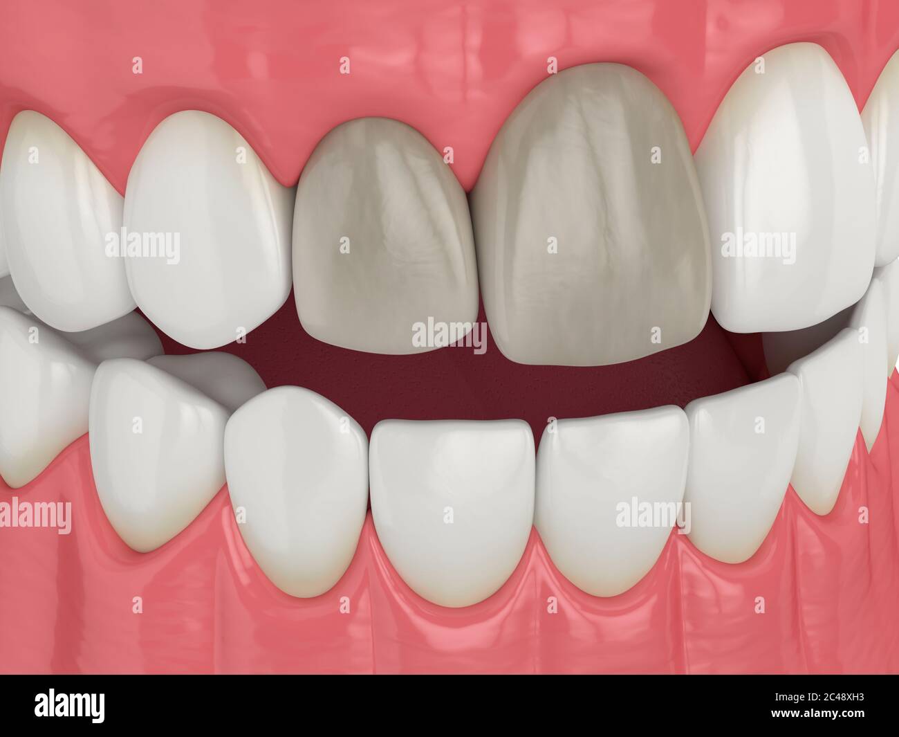 Human Lower Canine Teeth