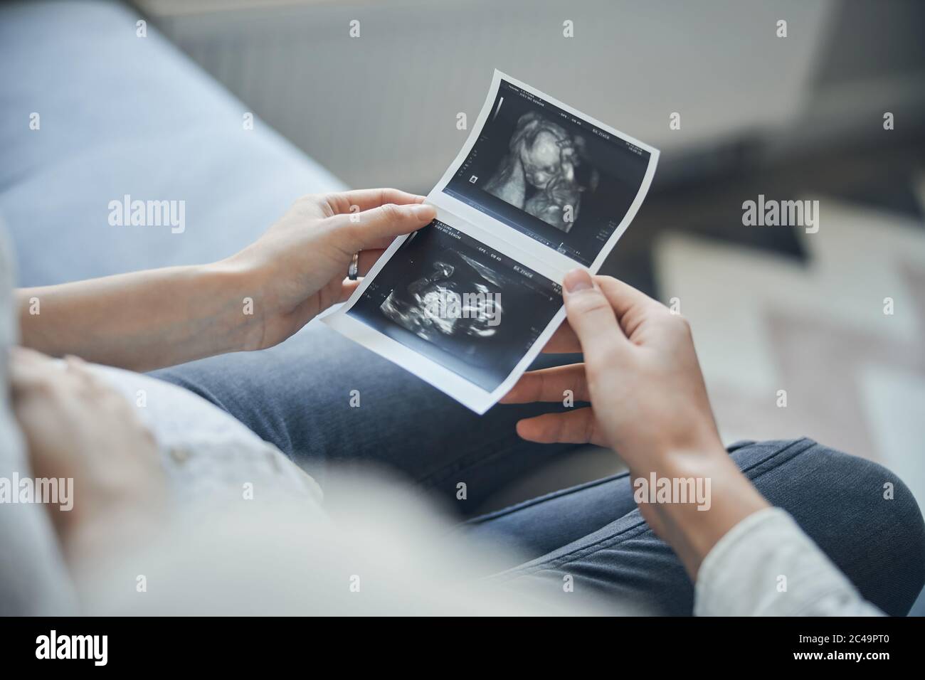 Male baby scan hi-res stock photography and images - Alamy