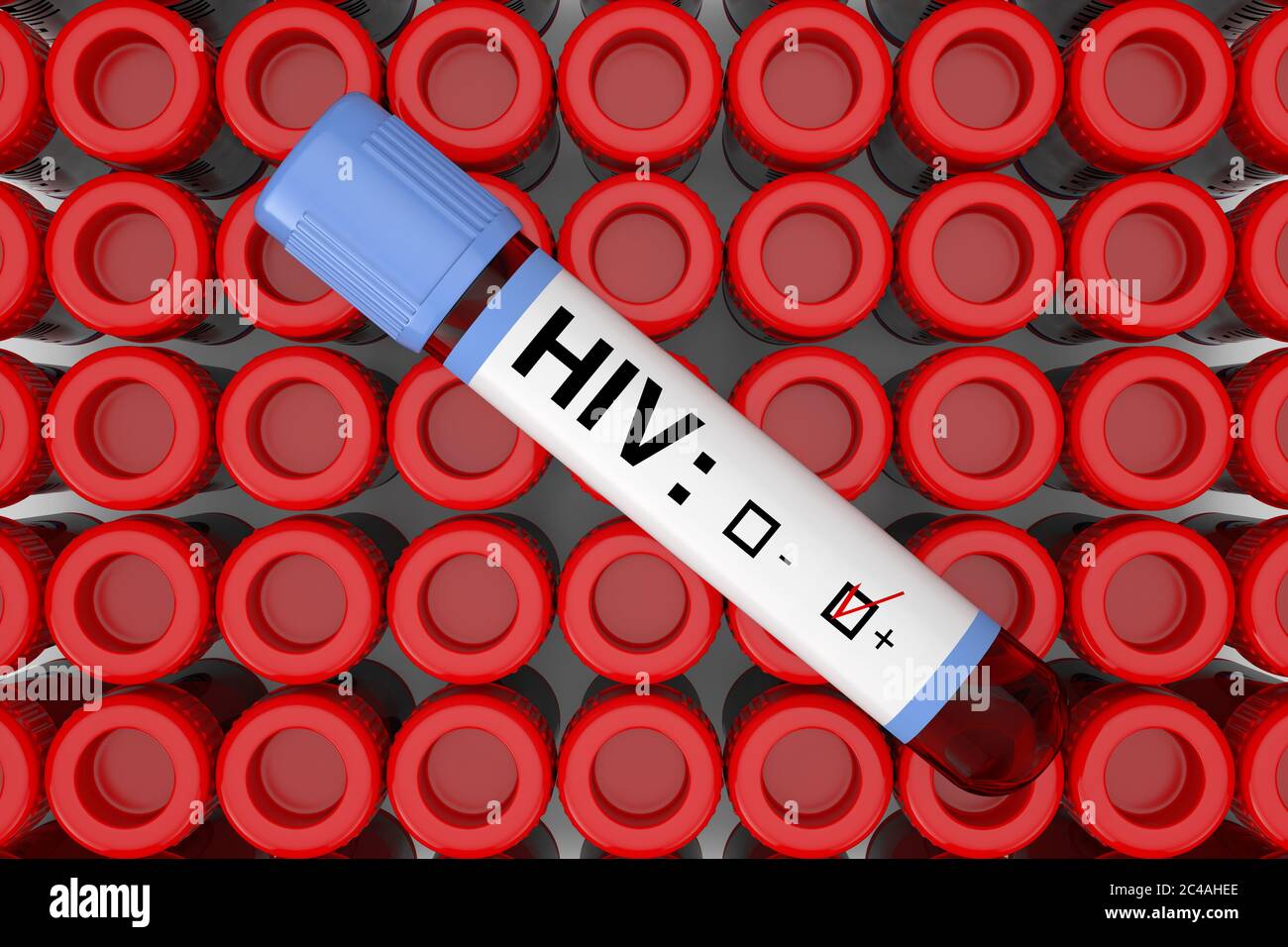 Positive hiv blood test hi-res stock photography and images - Alamy