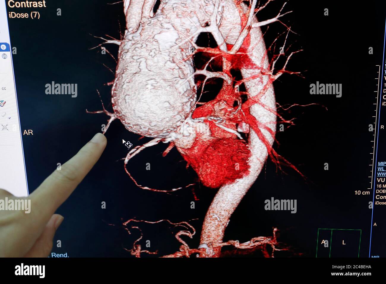 Man on cardio monitor hi-res stock photography and images - Alamy