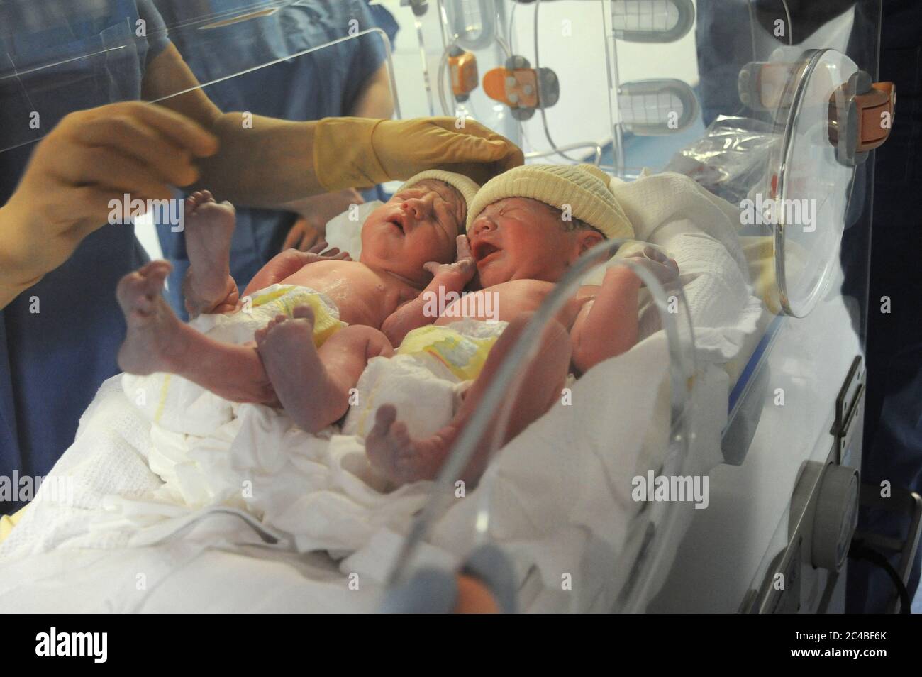 Cesarean Twins