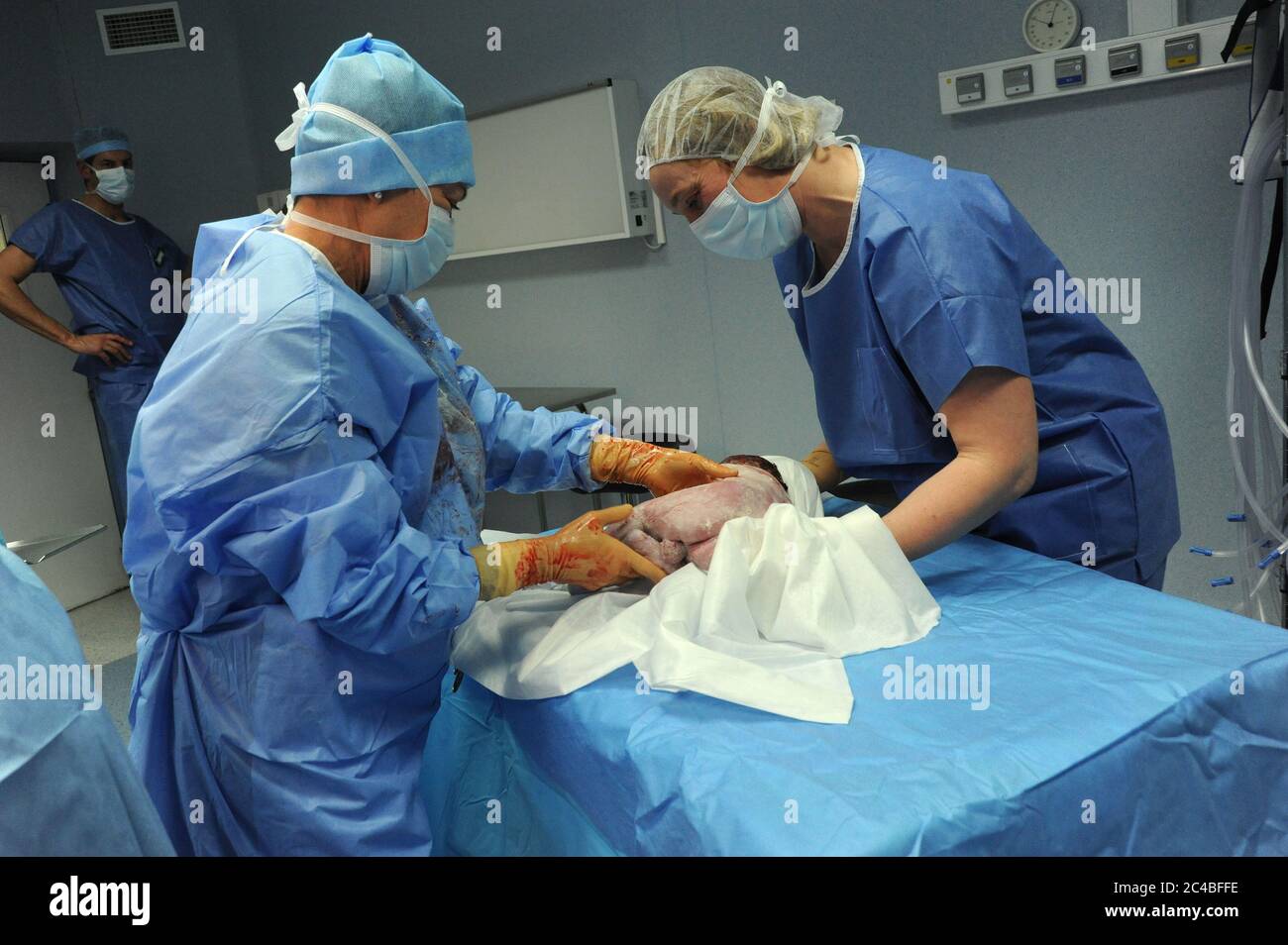 Cesarean delivery hi-res stock photography and images - Alamy