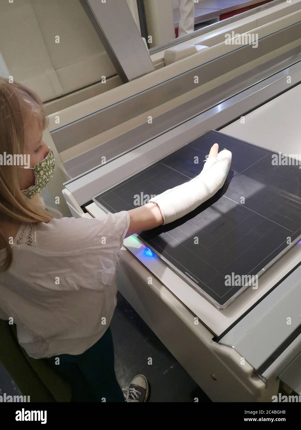 Broken wrist control x-ray Stock Photo - Alamy