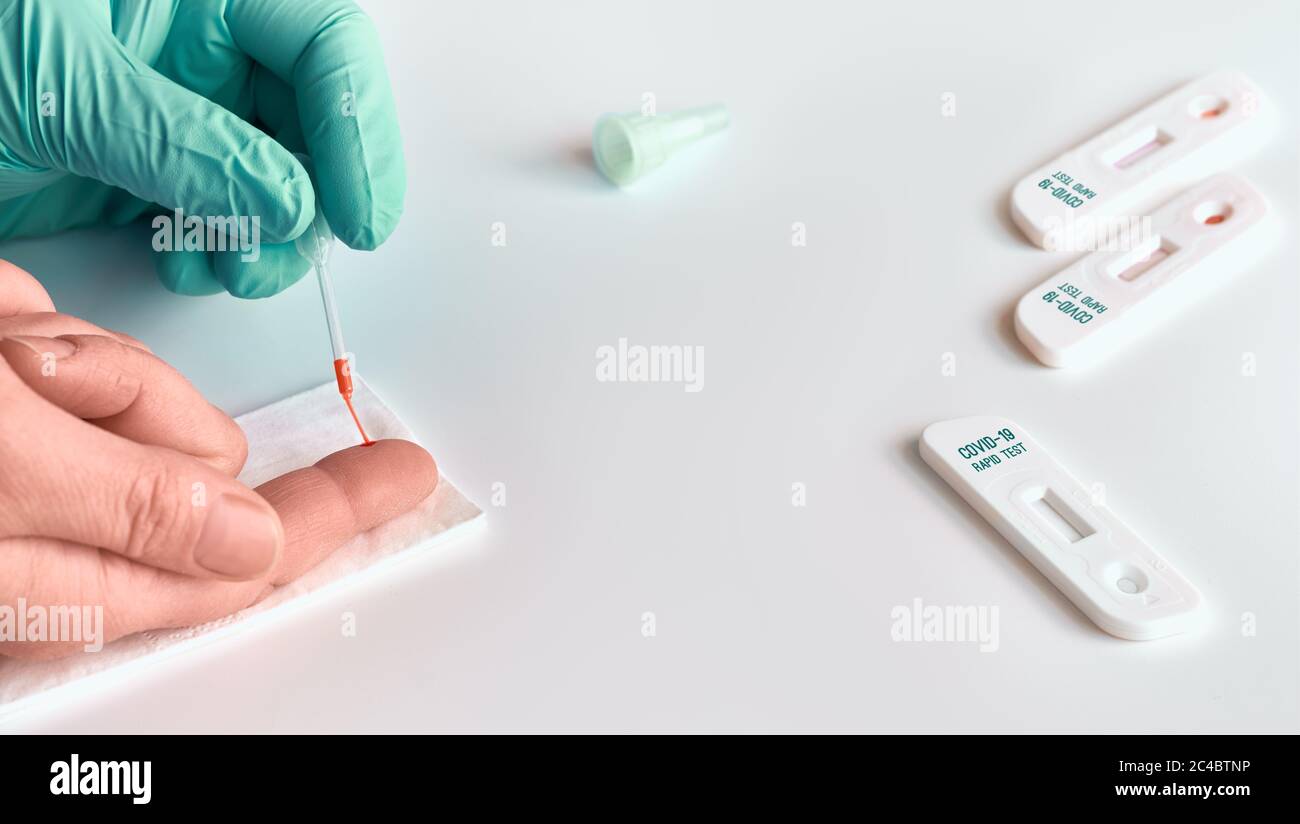 Rapid express COVID19 test for detection of specific antibodies to ...