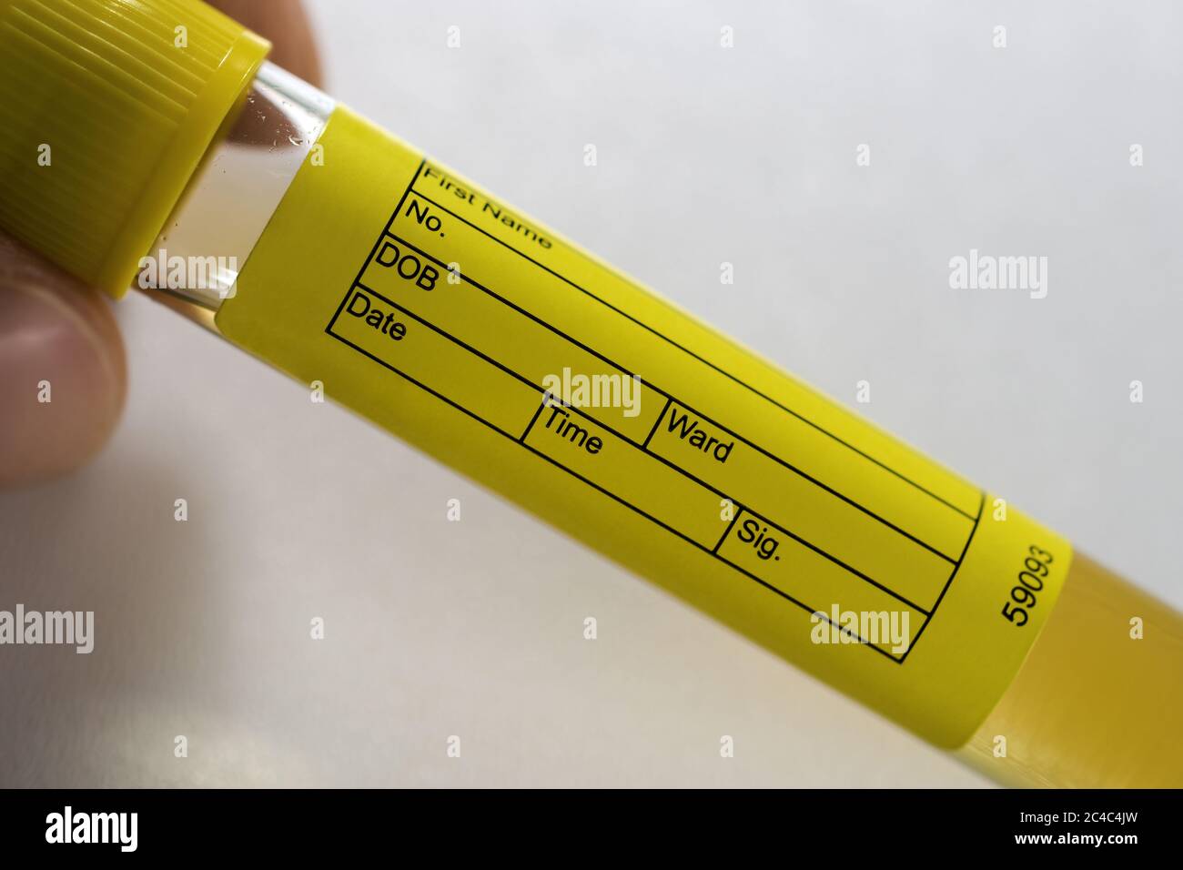 Urine sample speciman probe in test check analysis screening bottle ...