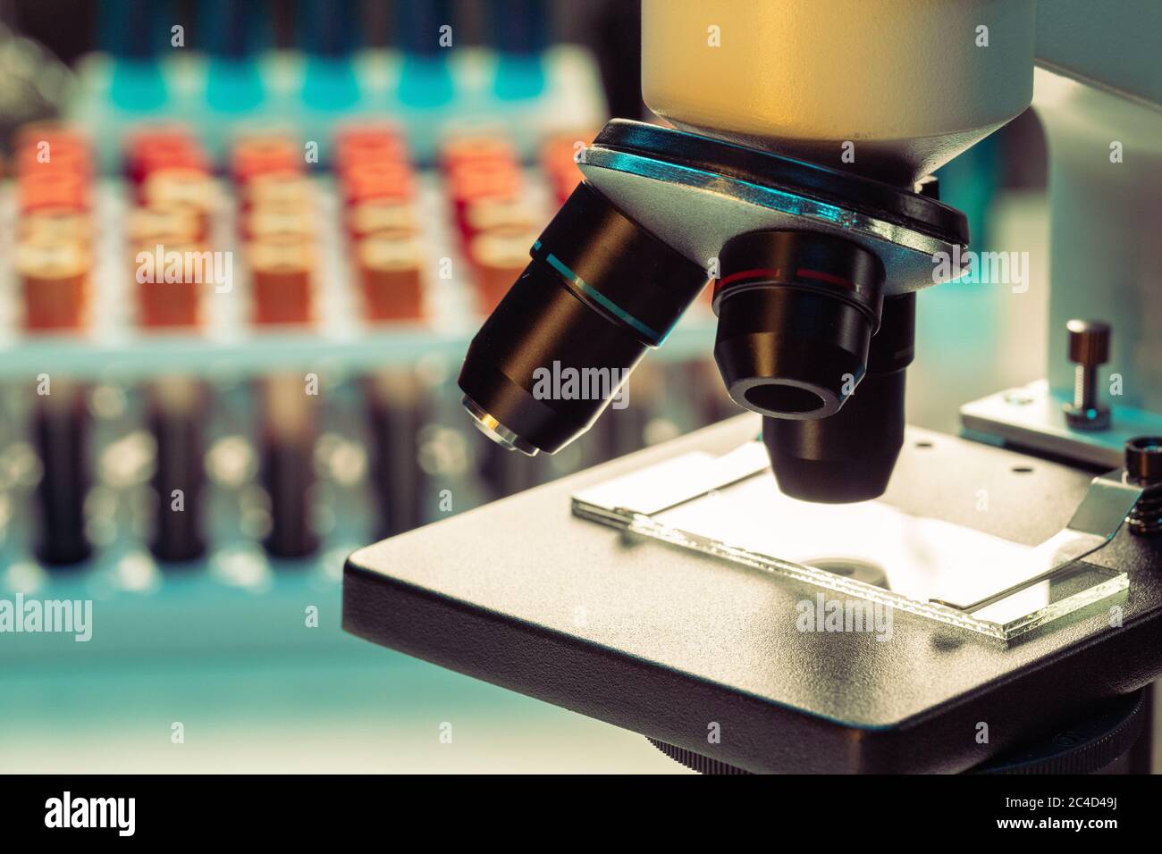 Close up photo of microscope with test tubes with blood samples Stock ...