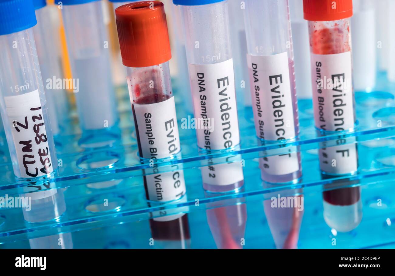 Kastle meyer blood hi-res stock photography and images - Alamy