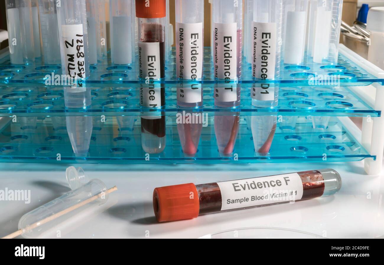 Hematological analysis with forensic test kit in a murder in a crime ...