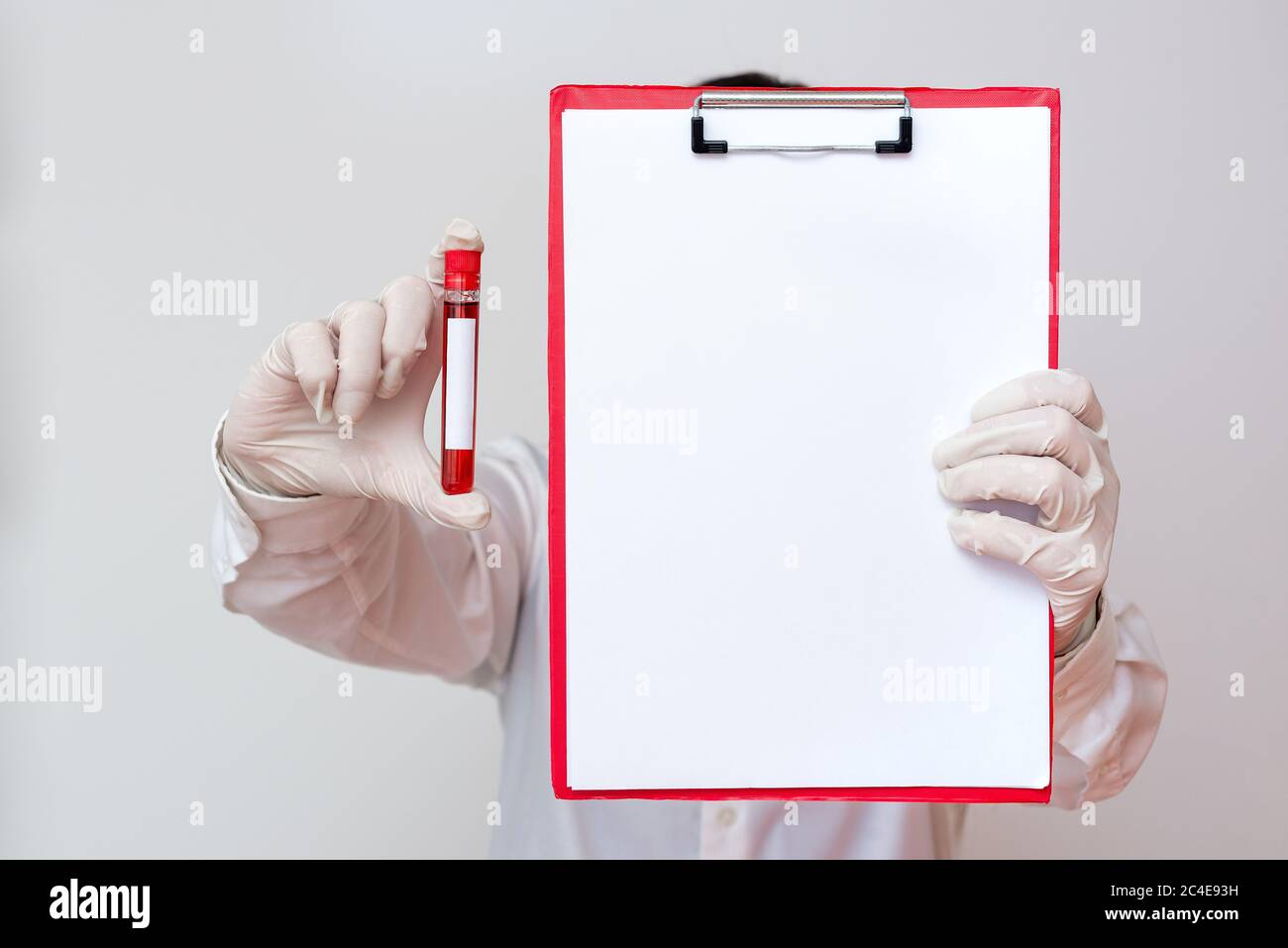 Laboratory Blood Test Sample Shown For Medical Diagnostic Analysis ...