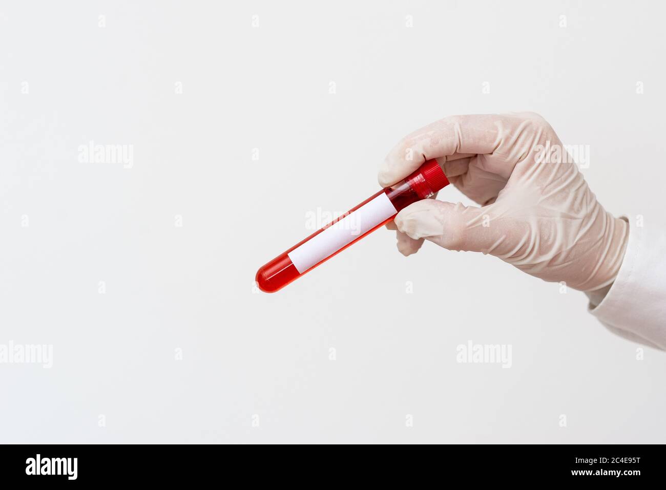Extracted Blood Sample Vial Ready For Medical Diagnostic Examination ...