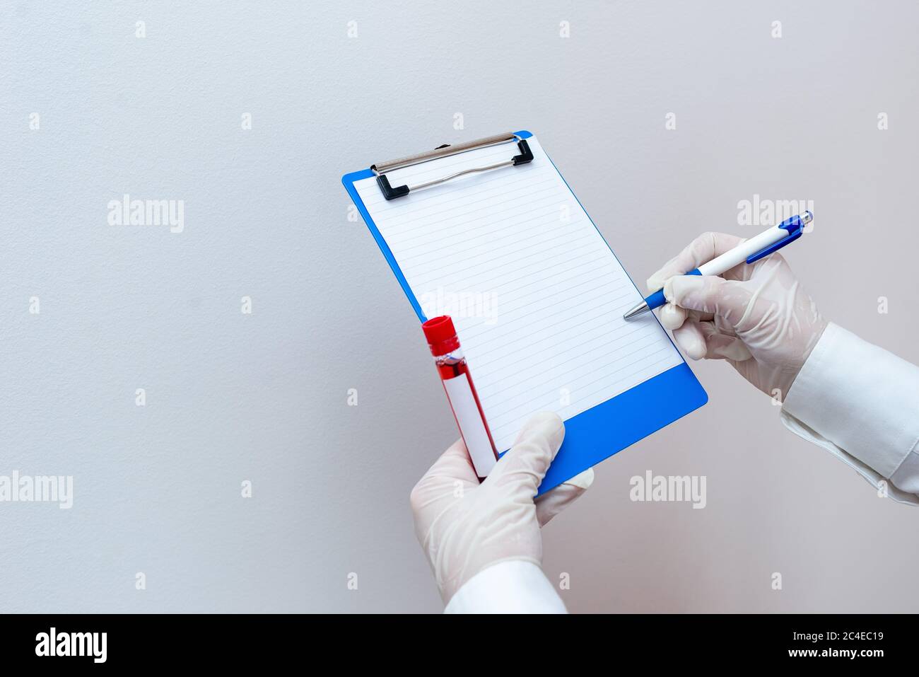Laboratory Blood Test Sample Shown For Medical Diagnostic Analysis ...