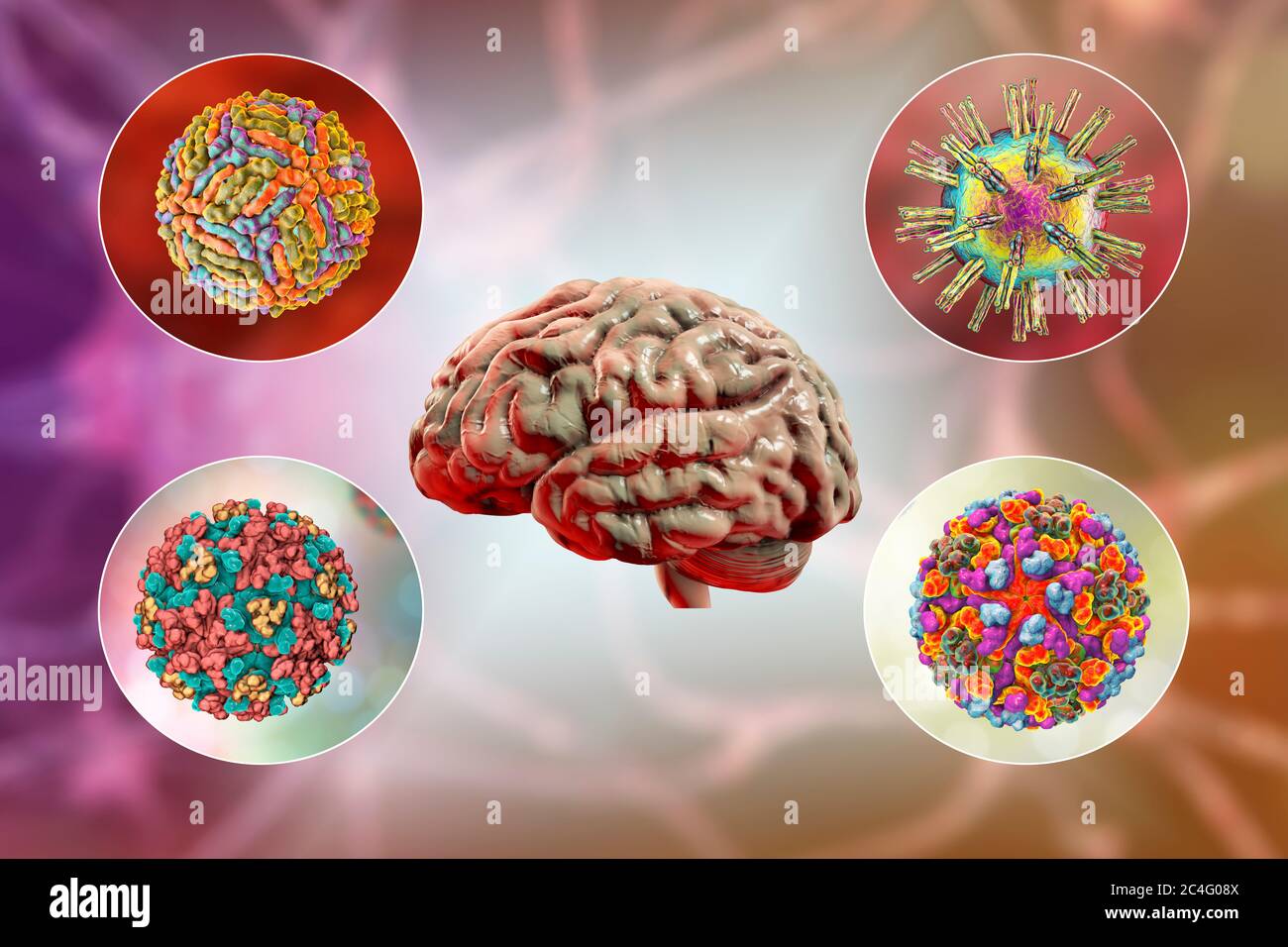 Brain infections. Computer illustration of microorganisms that cause ...