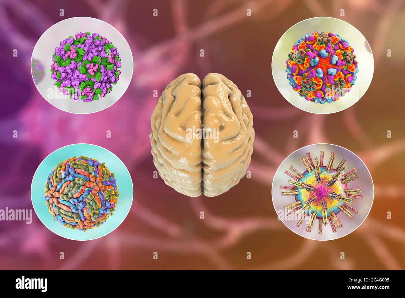 Brain infections. Computer illustration of microorganisms that cause ...