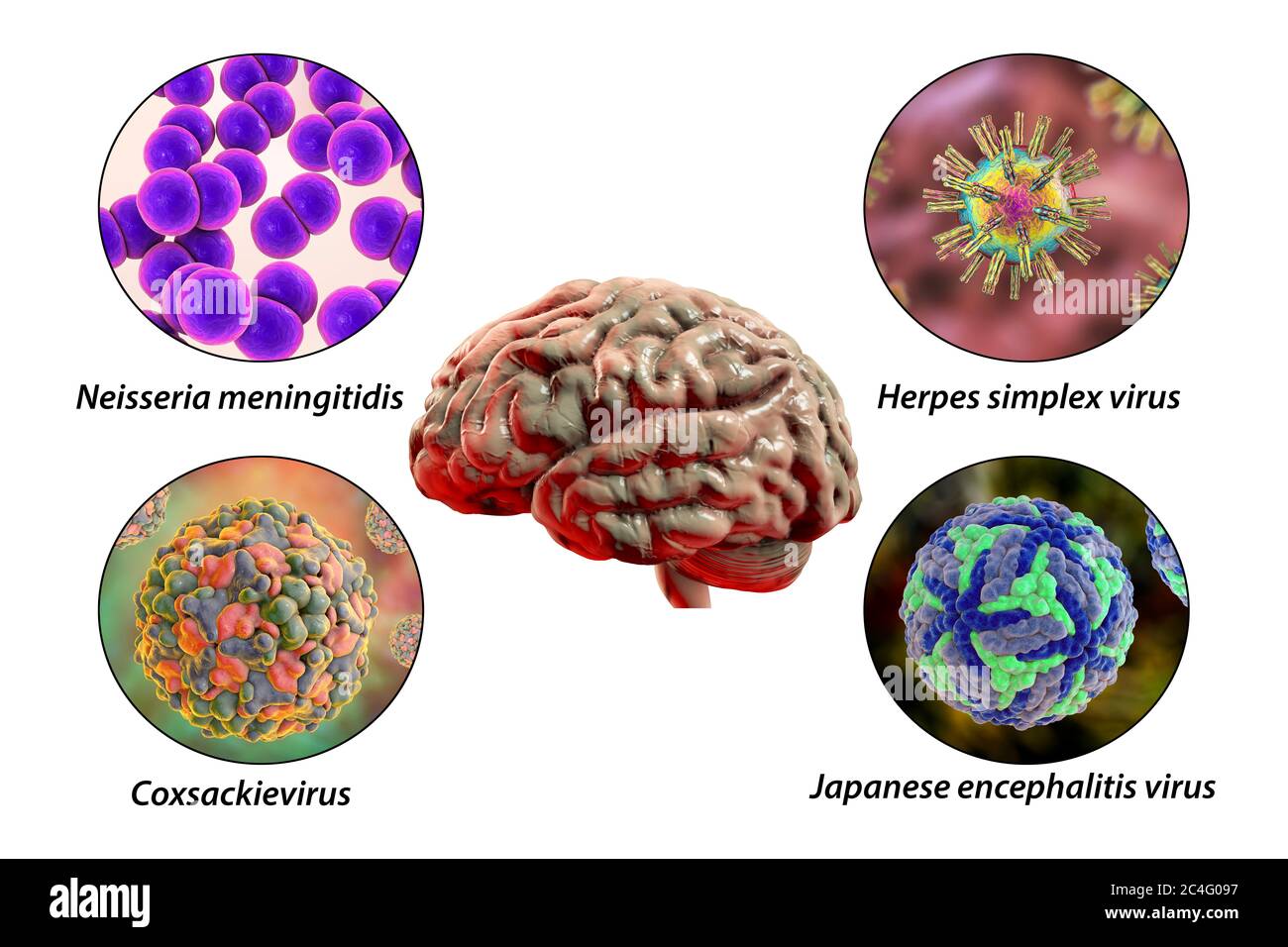 Brain infections. Computer illustration of microorganisms that cause ...