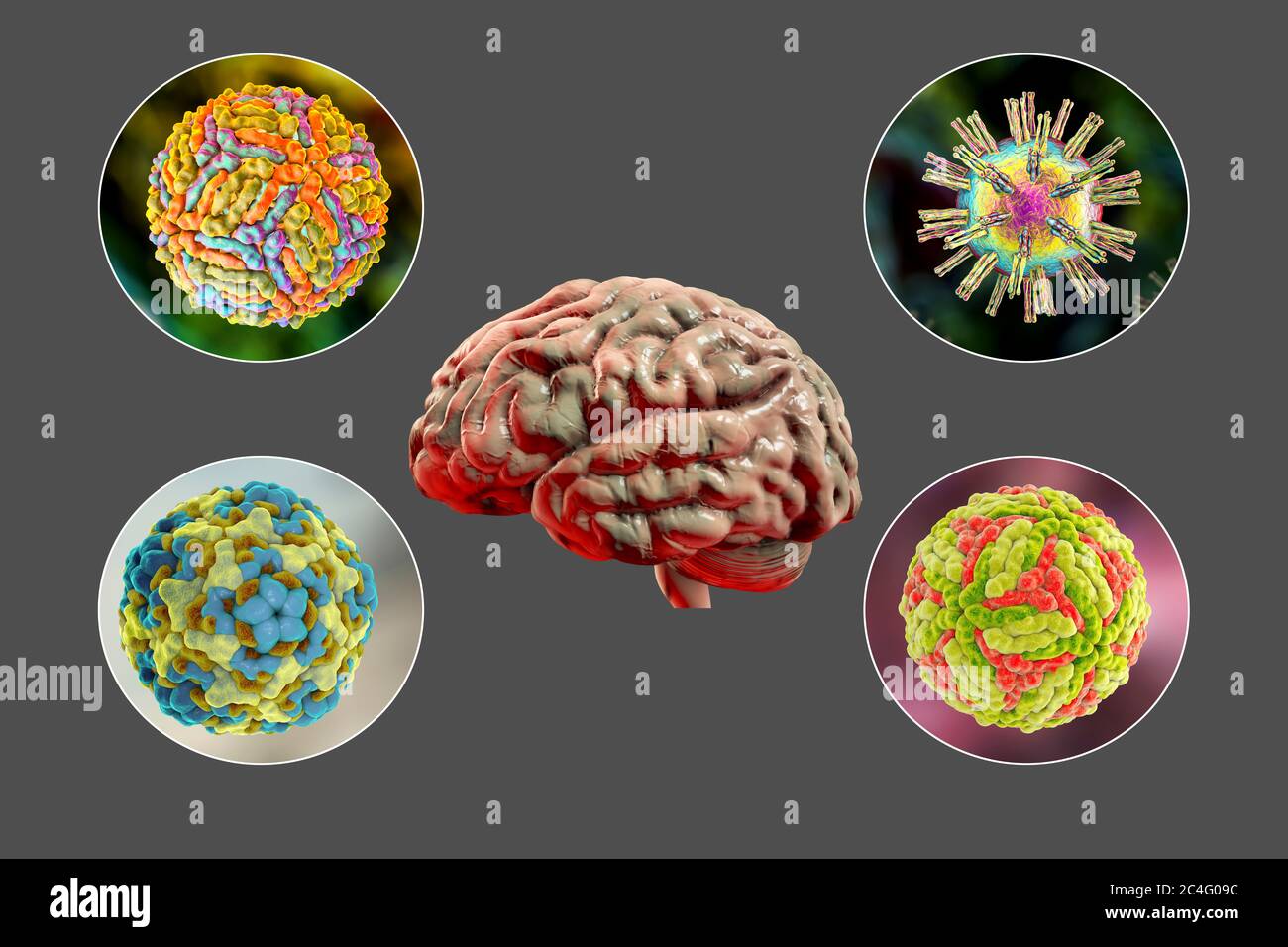 Brain infections. Computer illustration of microorganisms that cause ...