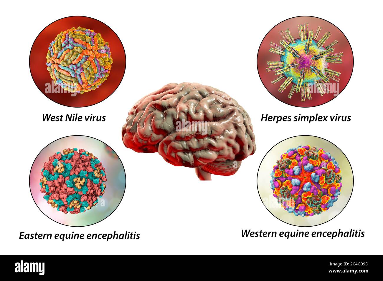 Brain infections. Computer illustration of microorganisms that cause ...