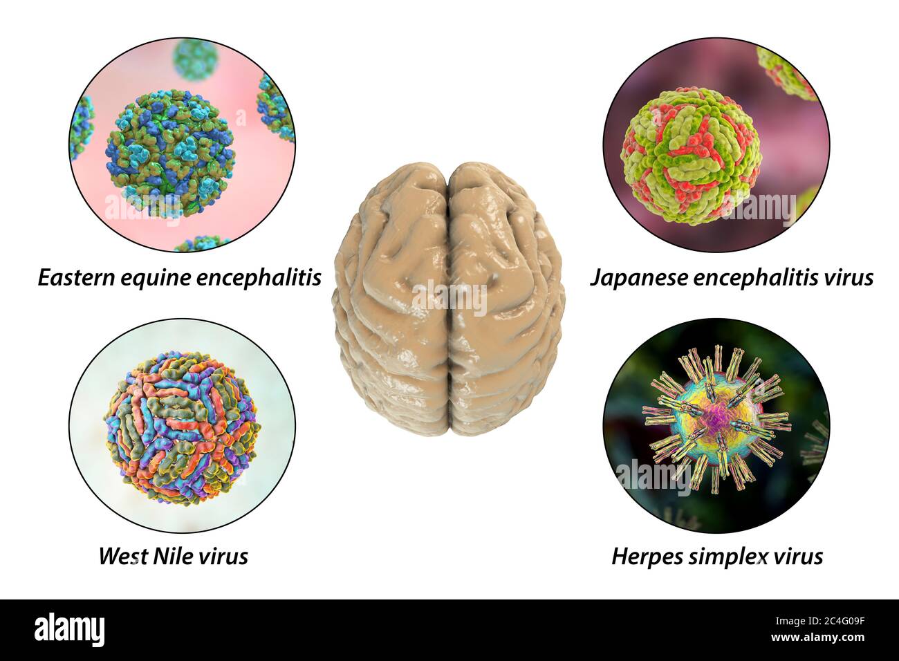 Brain infections. Computer illustration of microorganisms that cause ...