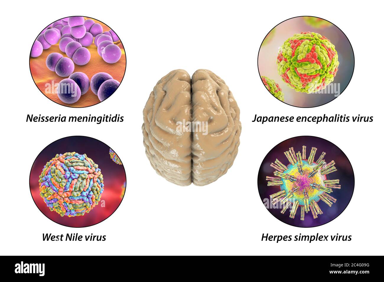 Brain infections. Computer illustration of microorganisms that cause ...