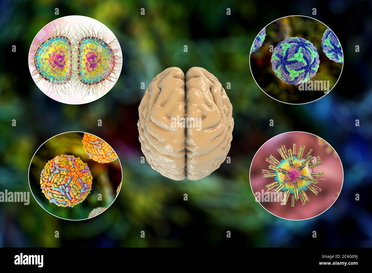 Brain infections. Computer illustration of microorganisms that cause ...