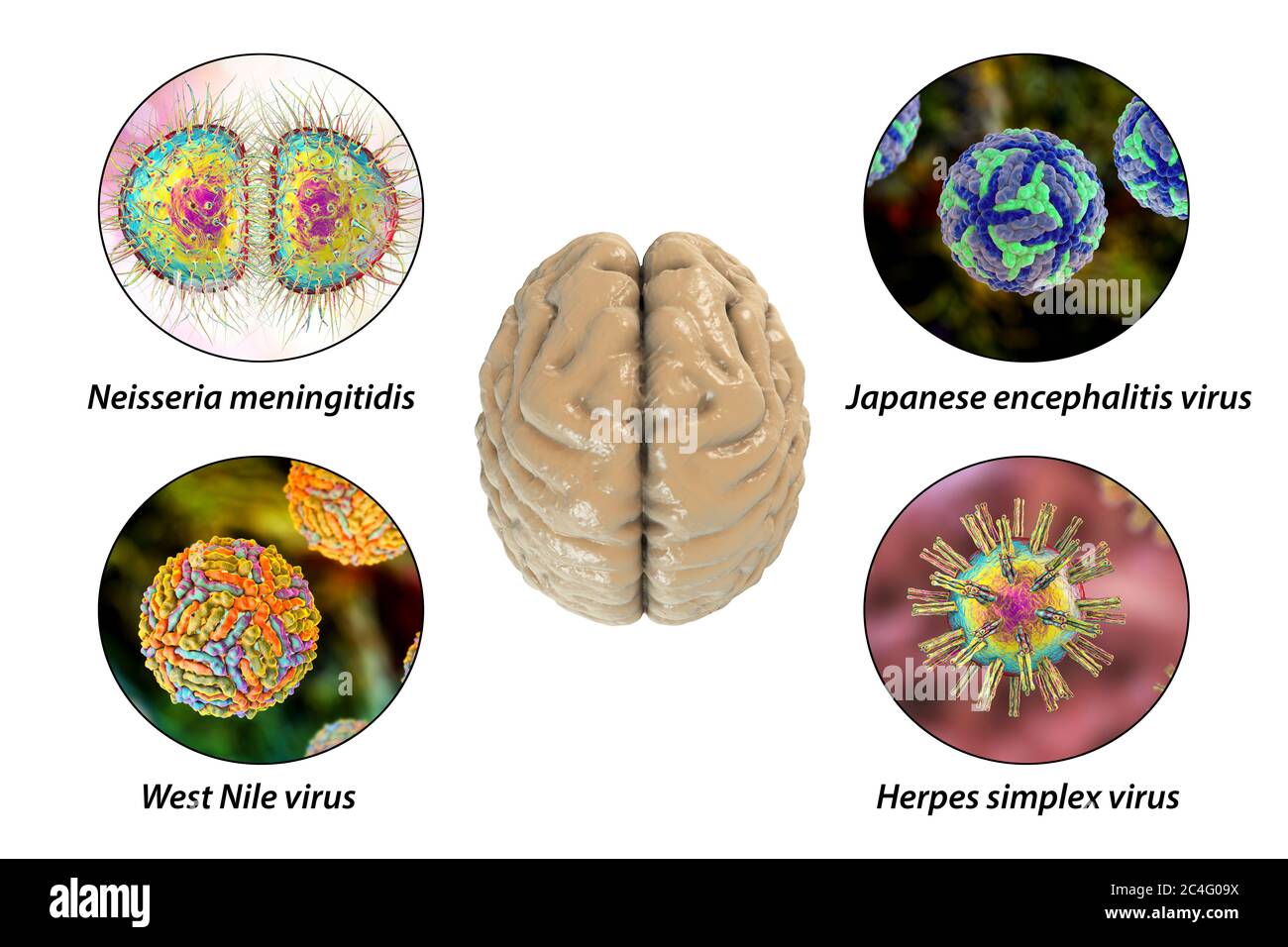 Brain infections. Computer illustration of microorganisms that cause ...