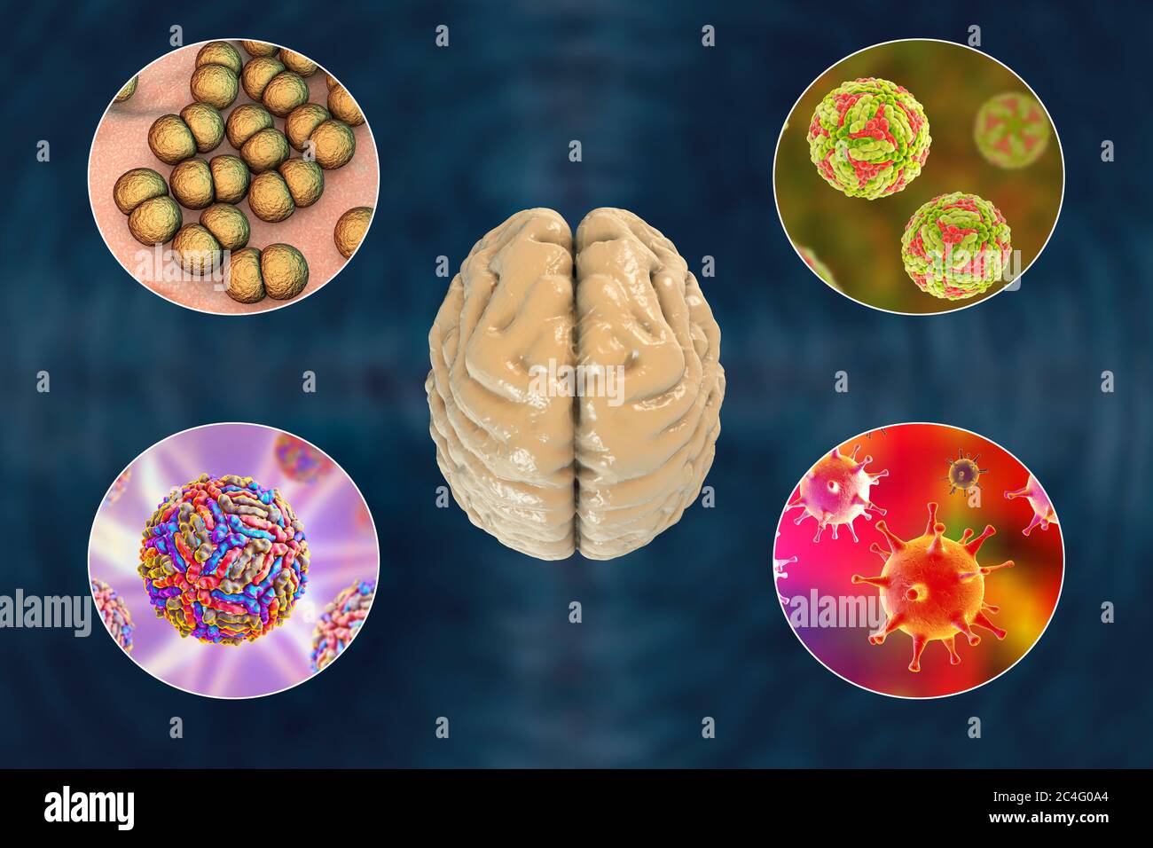 Brain infections. Computer illustration of microorganisms that cause ...