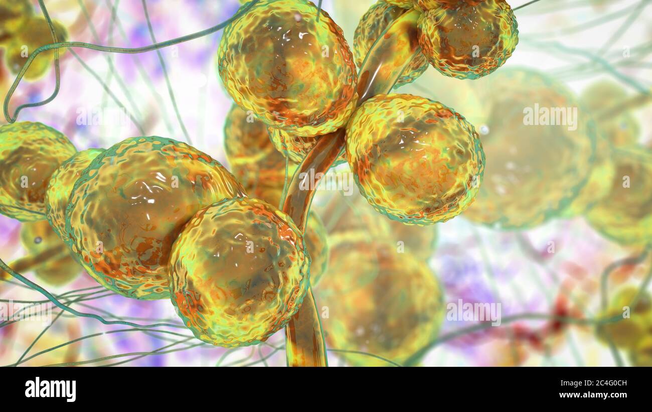 Candidiasis yeast infection hi-res stock photography and images - Alamy