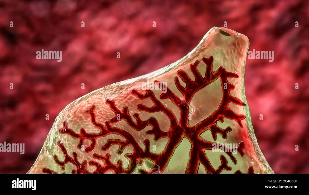 Liver fluke. Computer illustration of an adult liver fluke (Fasciola ...