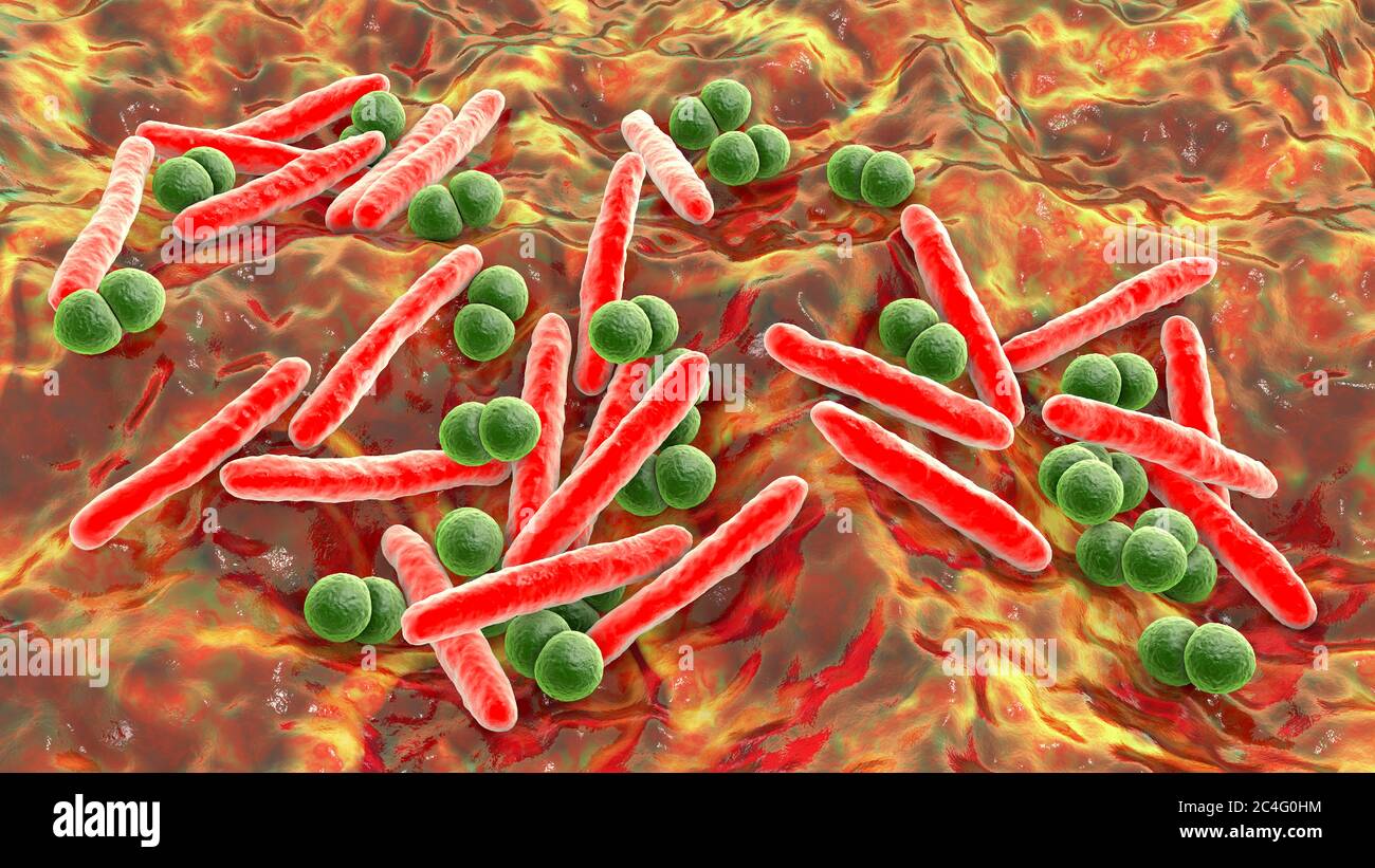 Tuberculosis bacteria computer artwork mycobacterium hi-res stock photography and images - Alamy