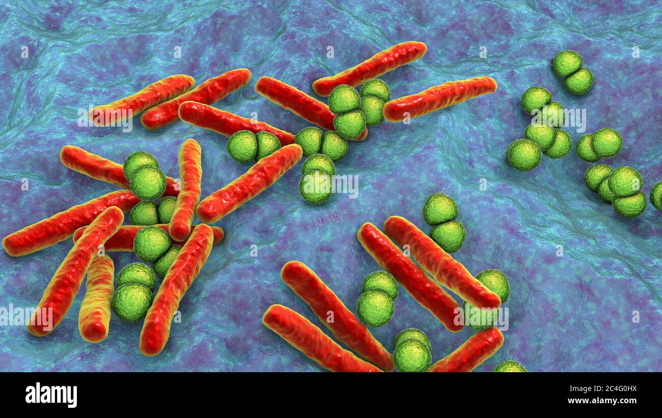 Computer illustration of co-infection with two major respiratory ...