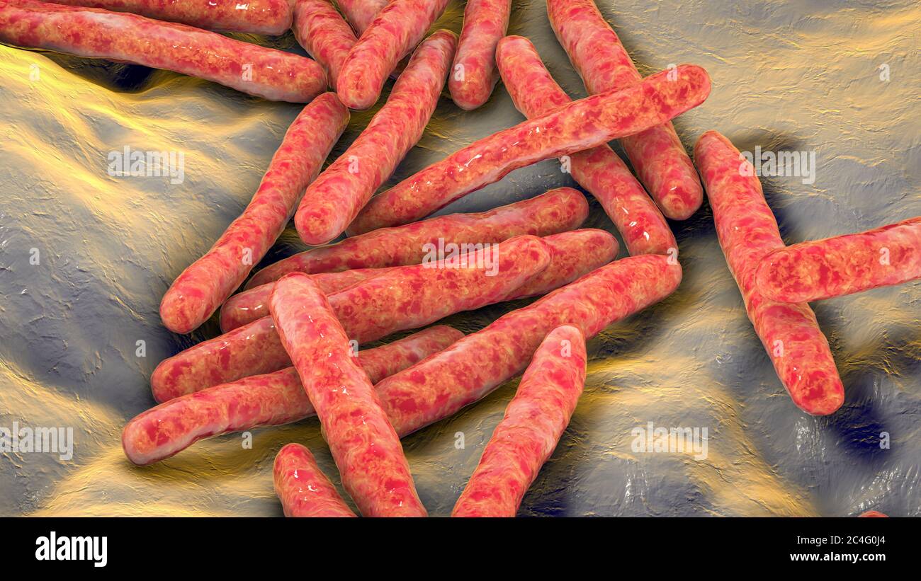 Tuberculosis bacteria. Computer illustration of Mycobacterium ...