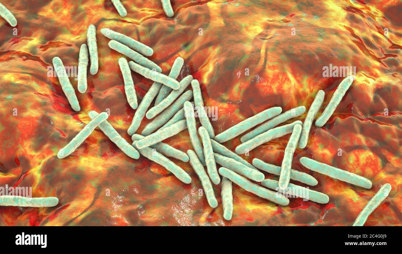 Tuberculosis bacteria. Computer illustration of Mycobacterium tuberculosis bacteria, the Gram ...