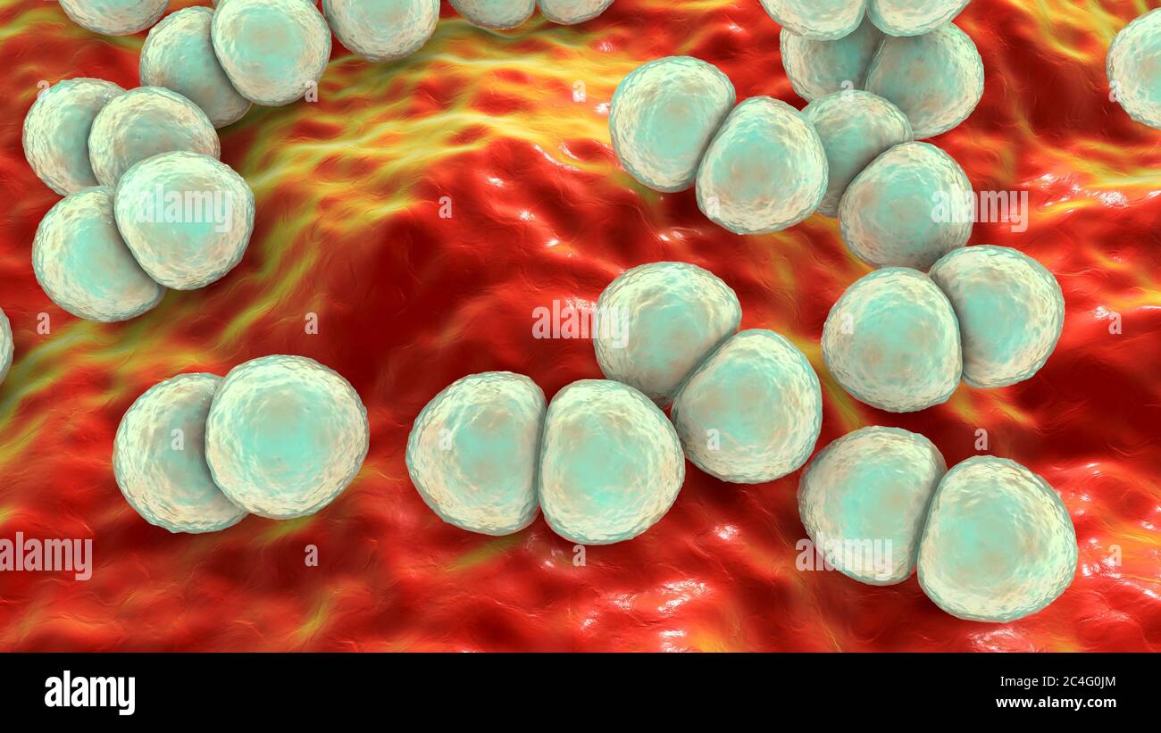 Streptococcus pneumoniae bacteria (pneumococci), computer illustration ...