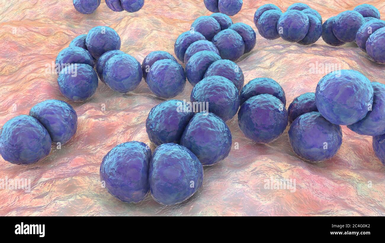Streptococcus pneumoniae bacteria (pneumococci), computer illustration ...