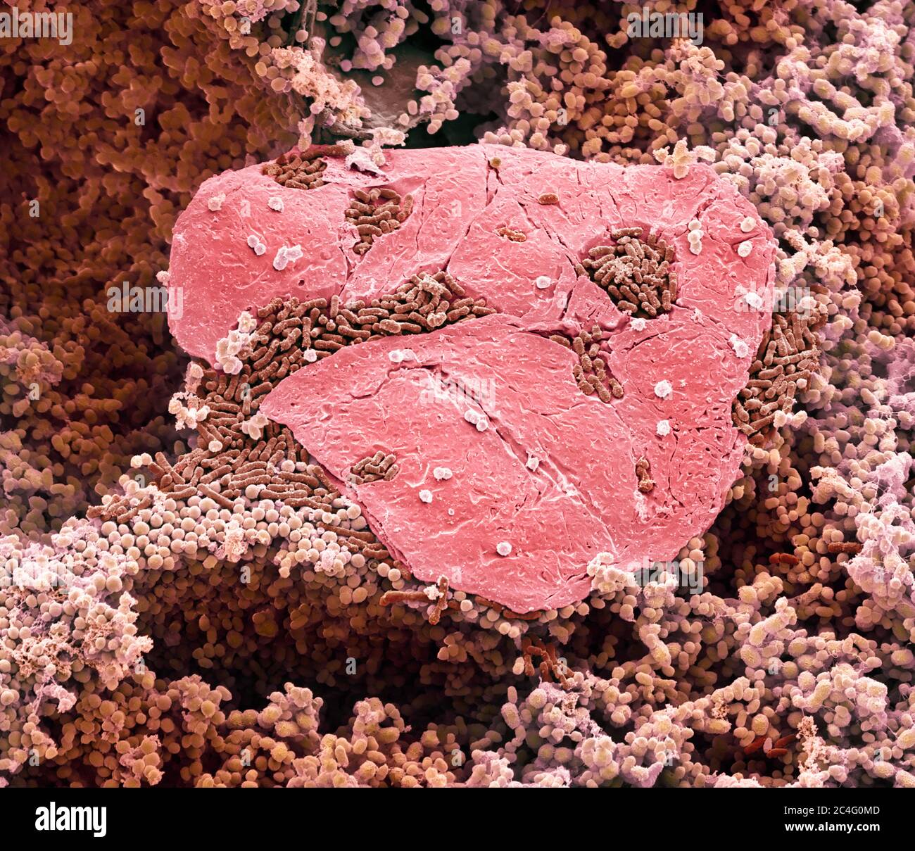 Feet bacteria. Coloured scanning electron micrograph (SEM) of bacteria ...