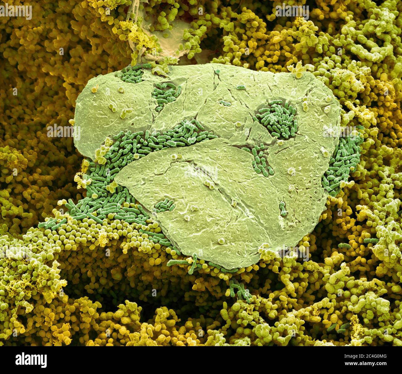 Feet bacteria. Coloured scanning electron micrograph (SEM) of bacteria ...